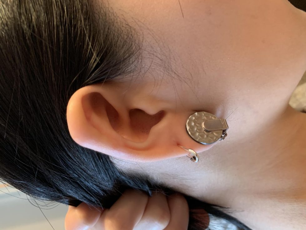 Commercial Ear Clip - Earpress - Ear Keloid Treatment